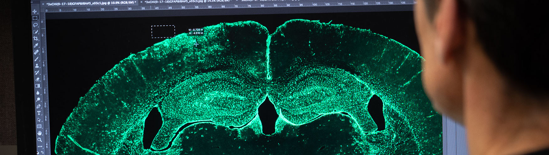 MEDSCHOOL, MEM, Research, TIRP